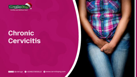 Chronic Cervicitis